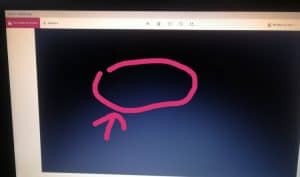 How to Fix Pressure Spots on LCD Screen? [Complete Guide]